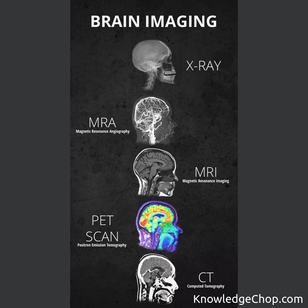 Brain imaging types | 🥷 Knowledge Ninja