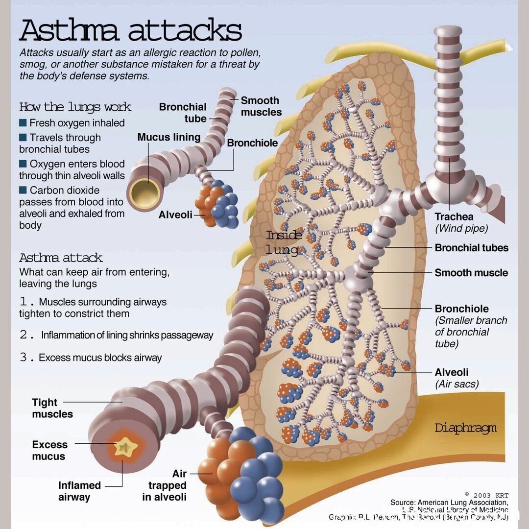 Asthma Attacks | 🥷 Knowledge Ninja