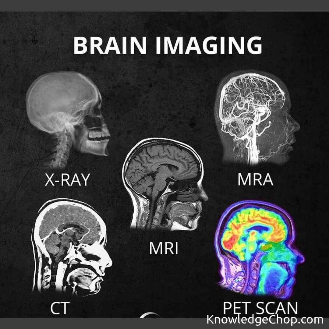 A cool guide to brain imaging | 🥷 Knowledge Ninja