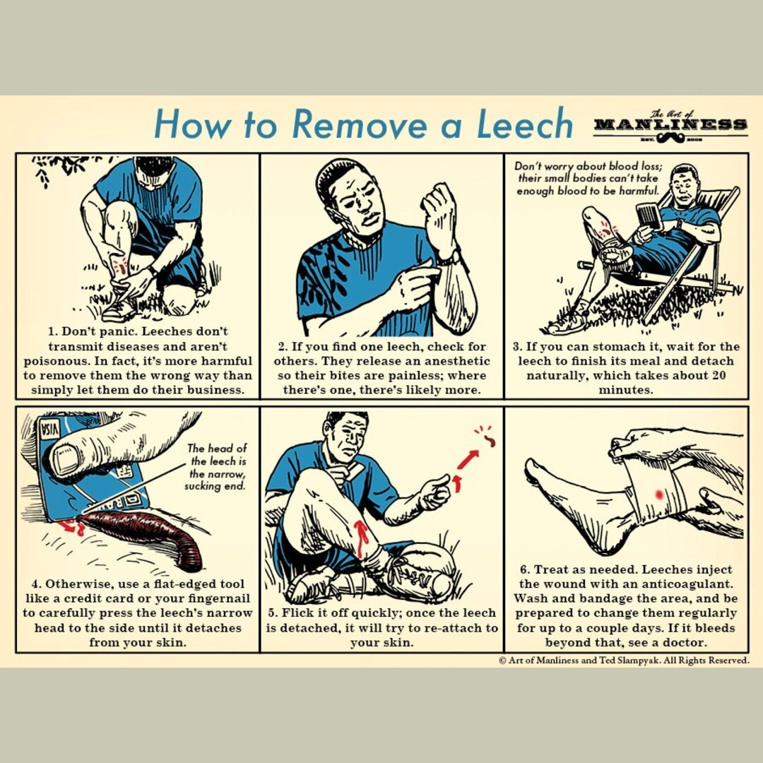 EMSK How to remove a leech
